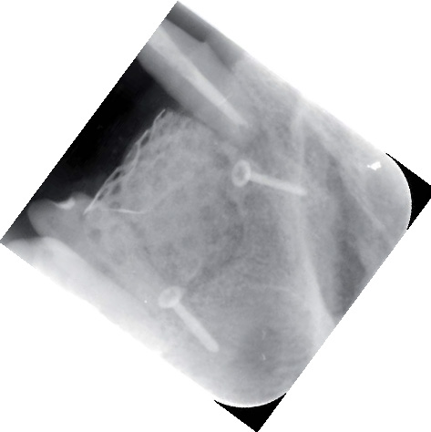 Screw System - jmpdental.de